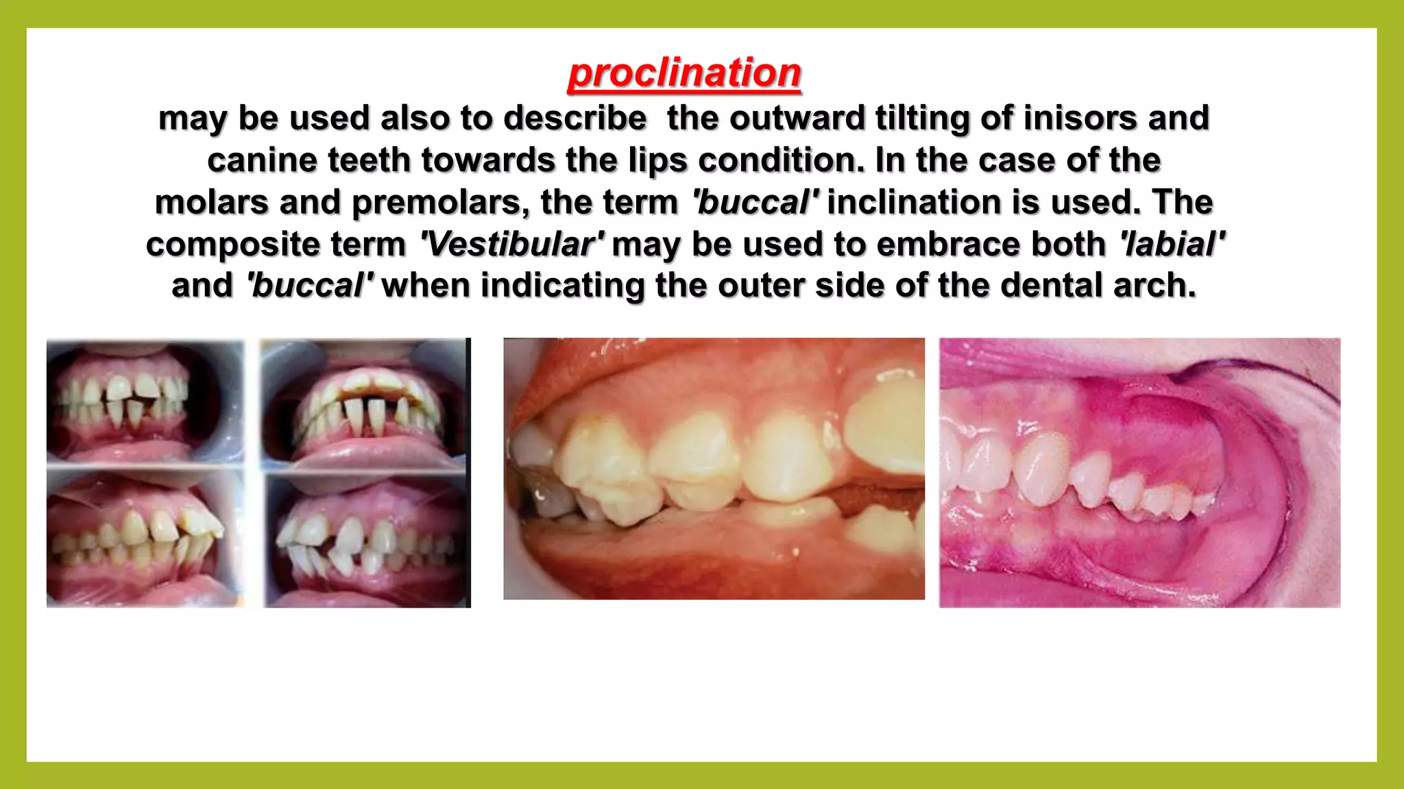 Malocclusion of teeth | PPTX
