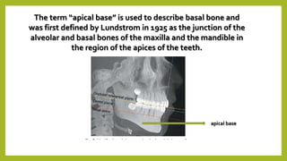 Malocclusion of teeth | PPTX