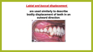 Malocclusion of teeth | PPTX