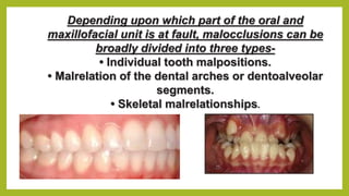Malocclusion of teeth | PPTX