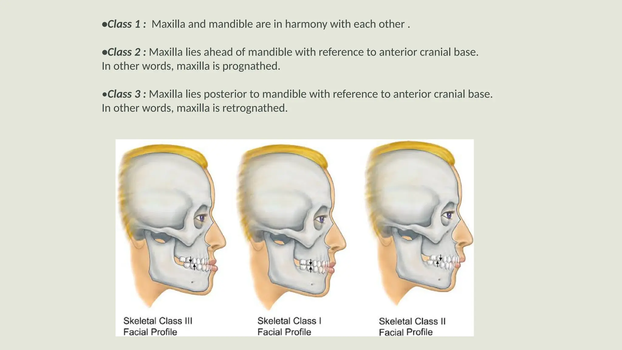 Classification of Dental Malocclusion | PPTX