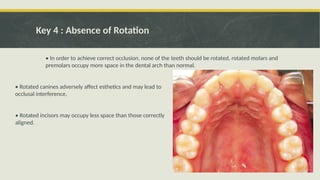 Classification of Dental Malocclusion | PPTX