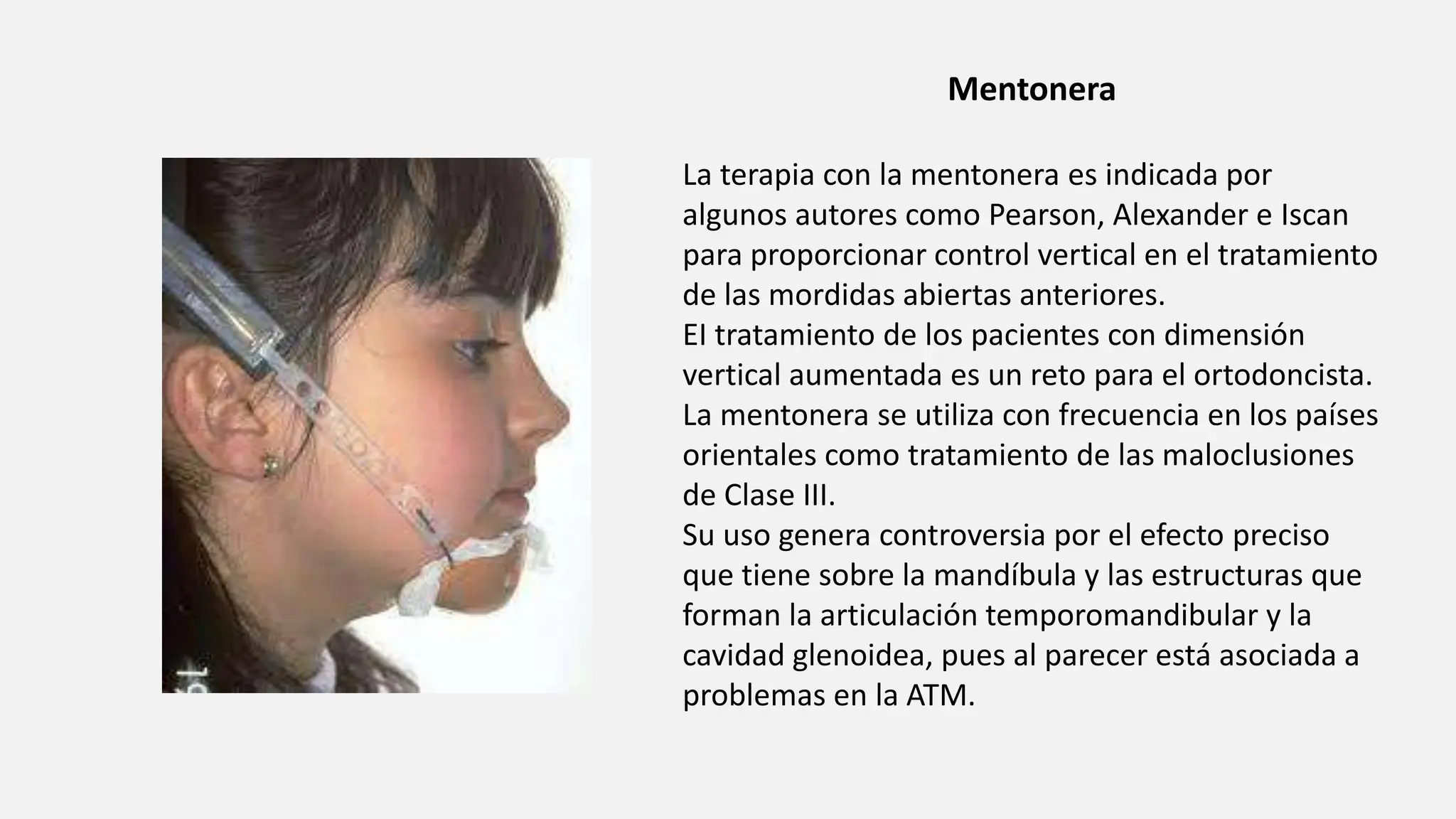 Maloclusión clase 3 dental y esqueletal en ortodoncia. | PPTX