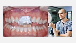Maloclusión clase 3 dental y esqueletal en ortodoncia. | PPTX