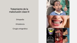 Maloclusión clase 3 dental y esqueletal en ortodoncia. | PPTX