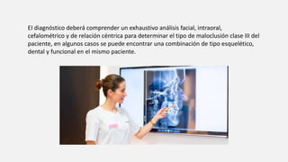 Maloclusión clase 3 dental y esqueletal en ortodoncia. | PPTX