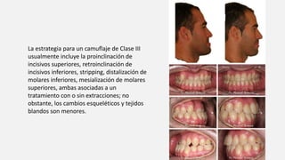 Maloclusión clase 3 dental y esqueletal en ortodoncia. | PPTX