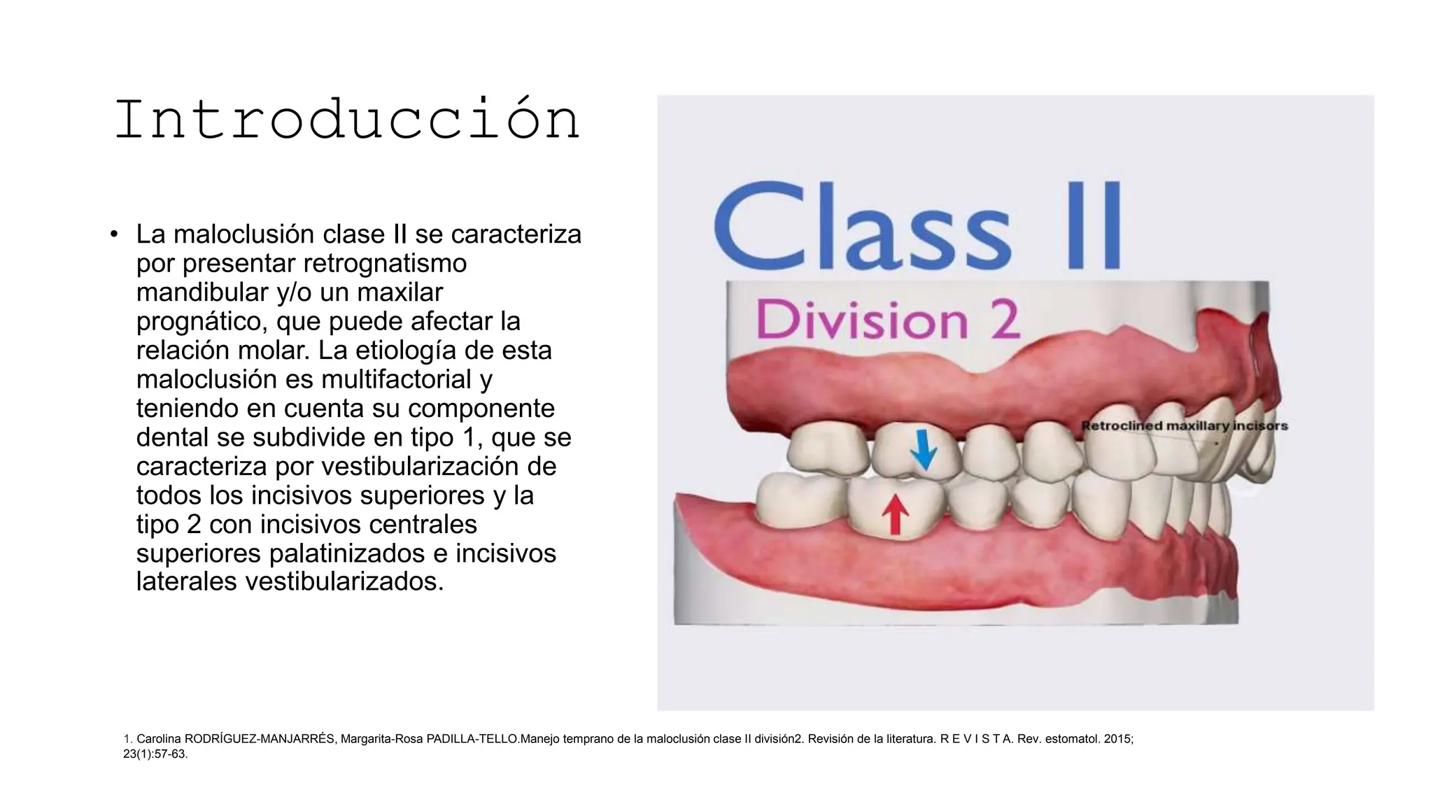 MAL OCLUSION CLASE II TRATAMIENTO INTERCEPTIVO.pptx