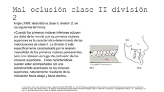 MAL OCLUSION CLASE II TRATAMIENTO INTERCEPTIVO.pptx