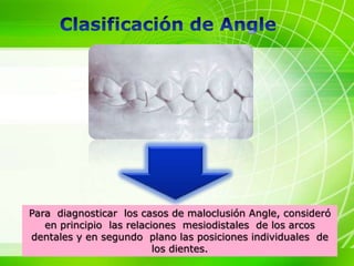 Maloclusiones | PPTX