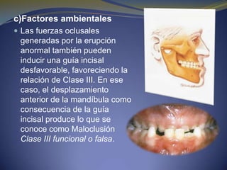 Maloclusiones de clase_iii | PPTX