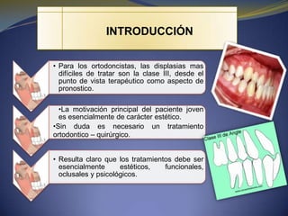 Maloclusiones de clase_iii | PPTX