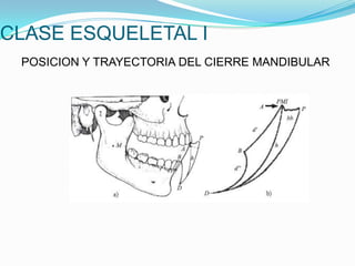 Maloclusiones esqueletales 8 vo | PPTX