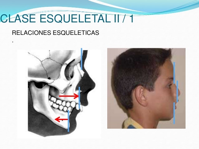 Maloclusiones esqueletales 8 vo