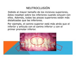 Maloclusion,Tipos y Clasificación | PDF