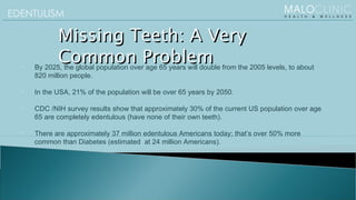 Edentulism & Revolutionary Treatment :- The "All-on-4" Dental Implant ...