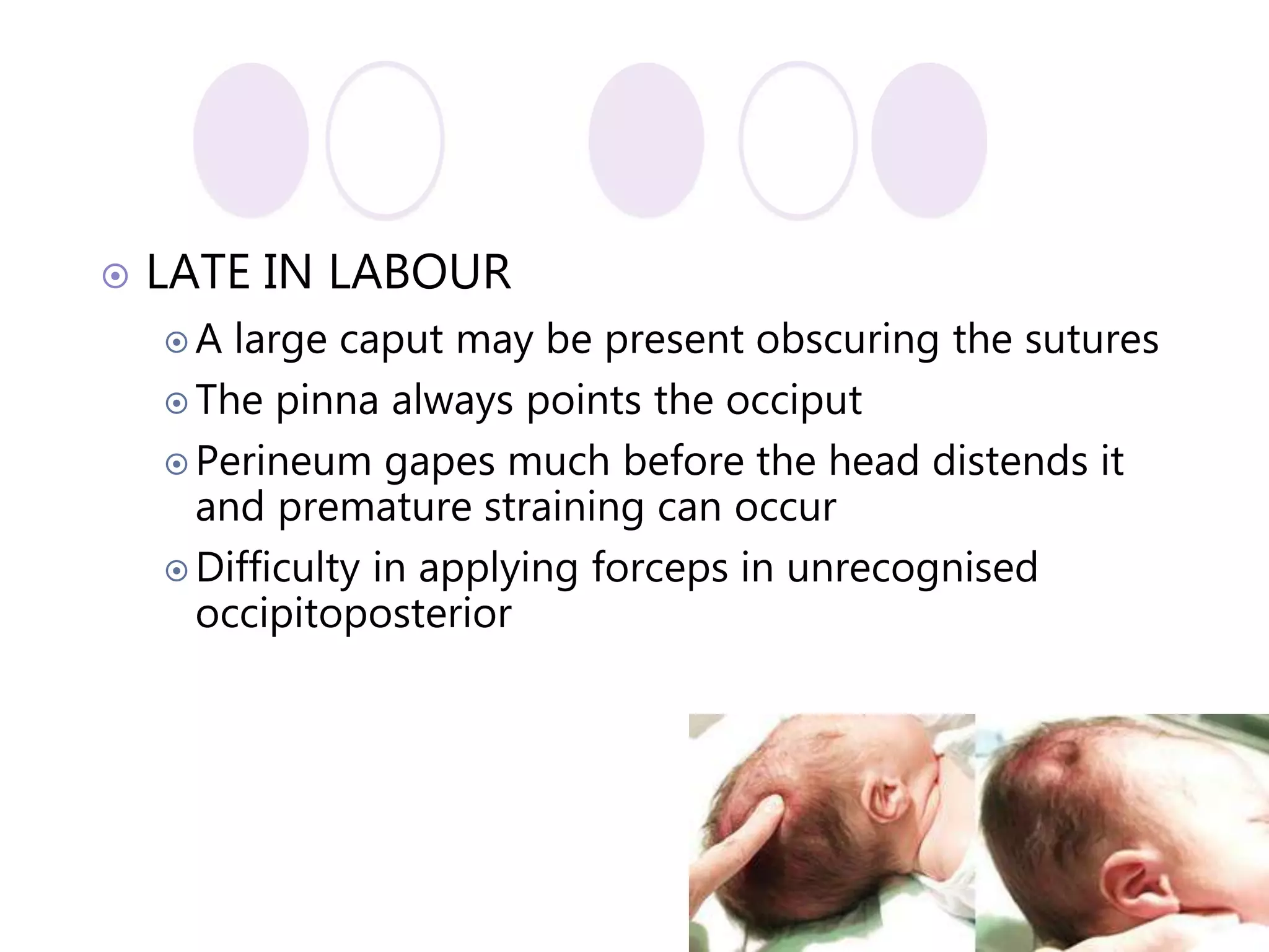 Malposition and malpresentations | PPTX