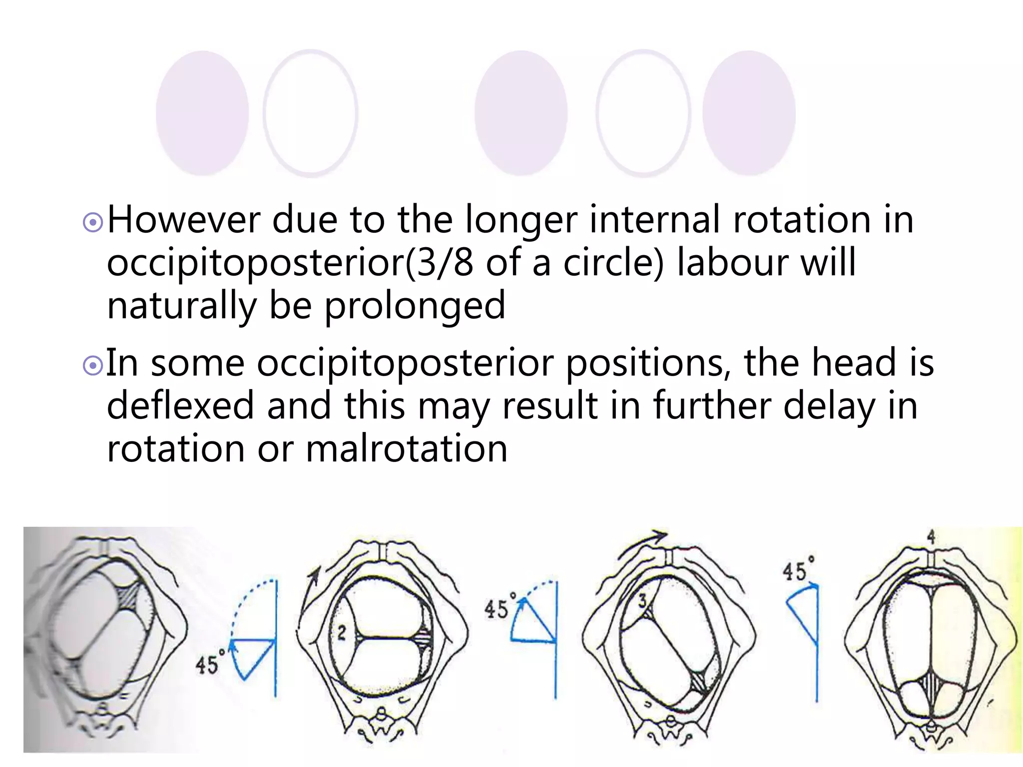 Malposition and malpresentations | PPTX