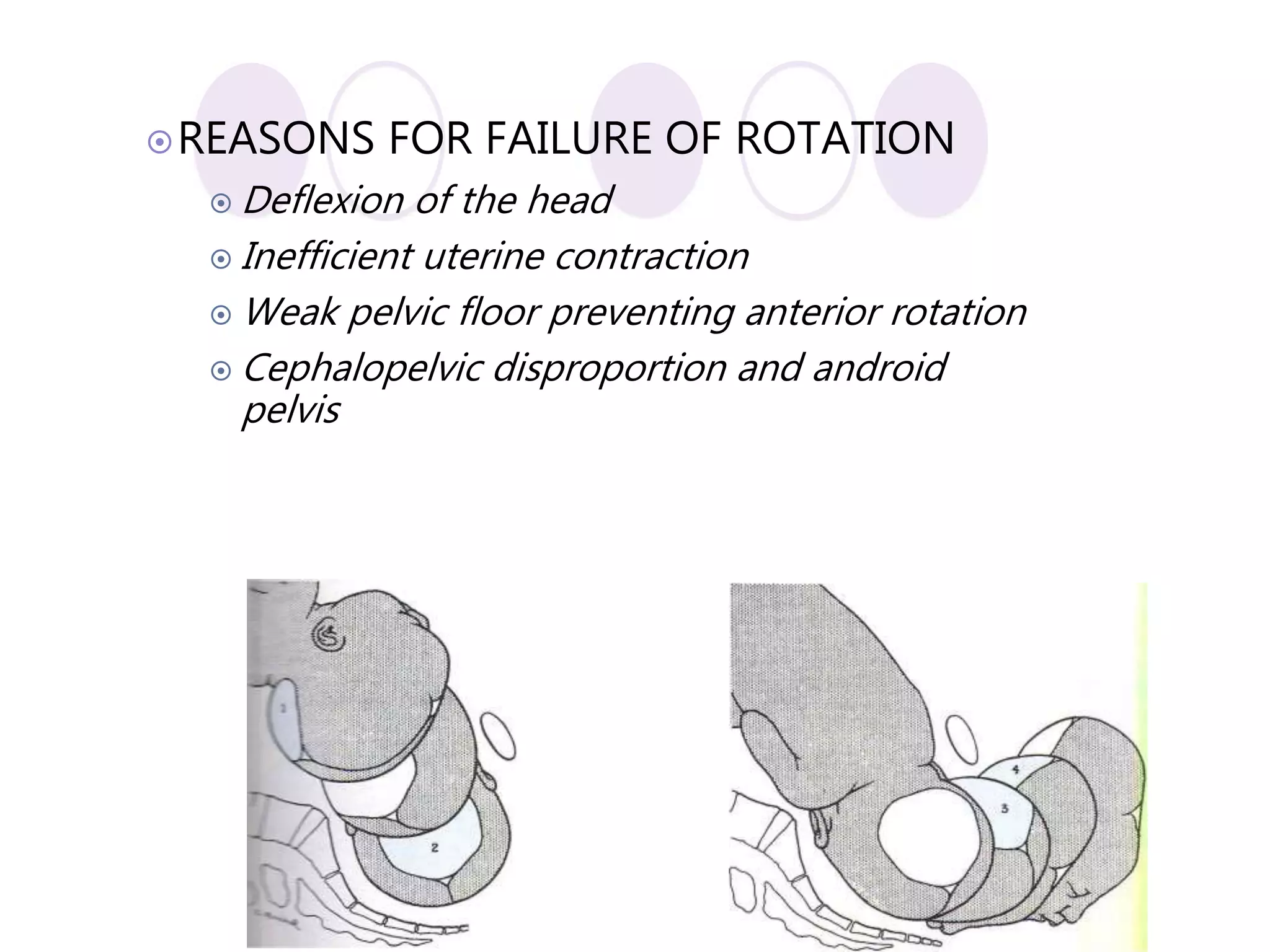 Malposition and malpresentations | PPTX