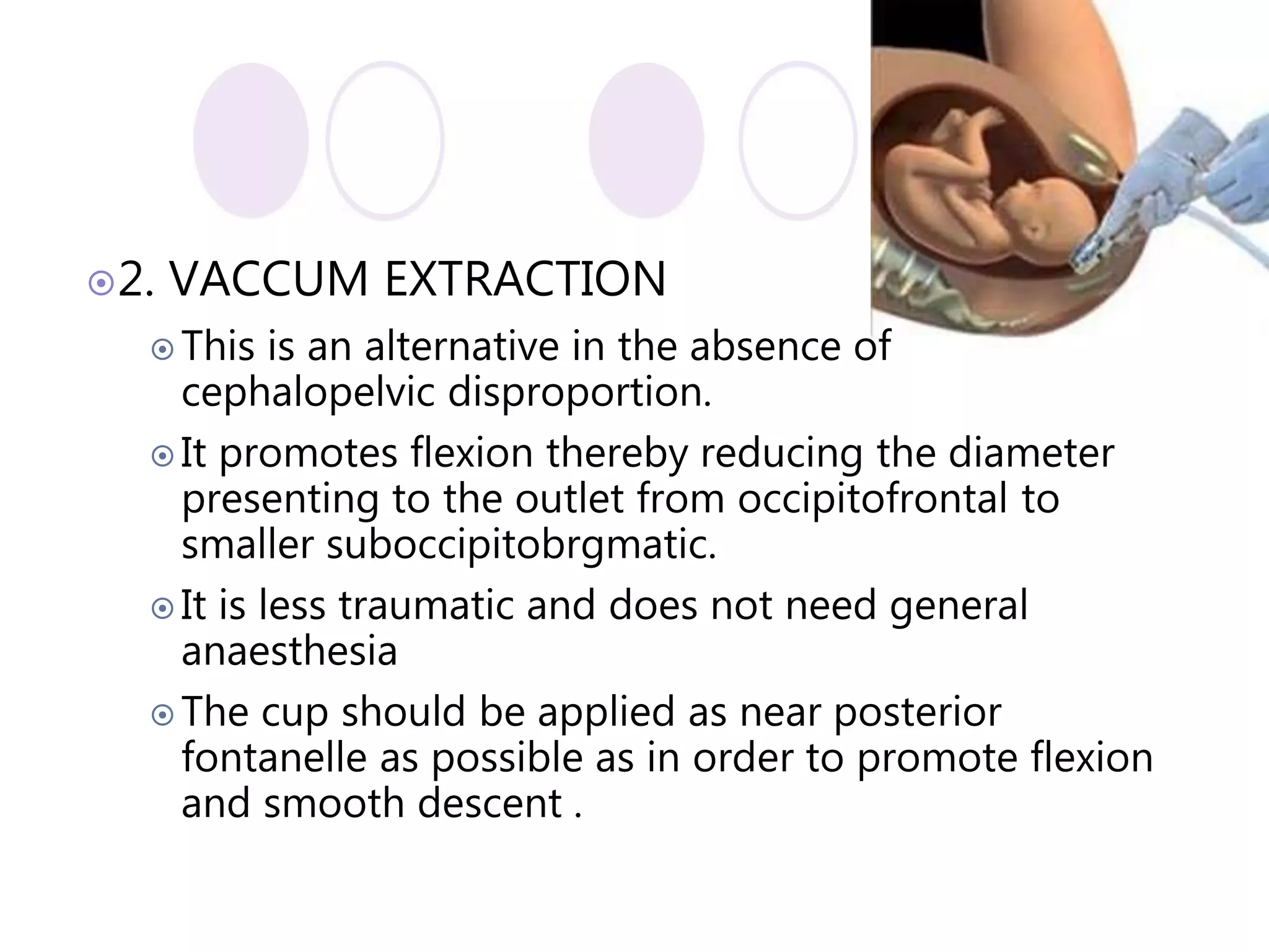 Malposition and malpresentations | PPTX