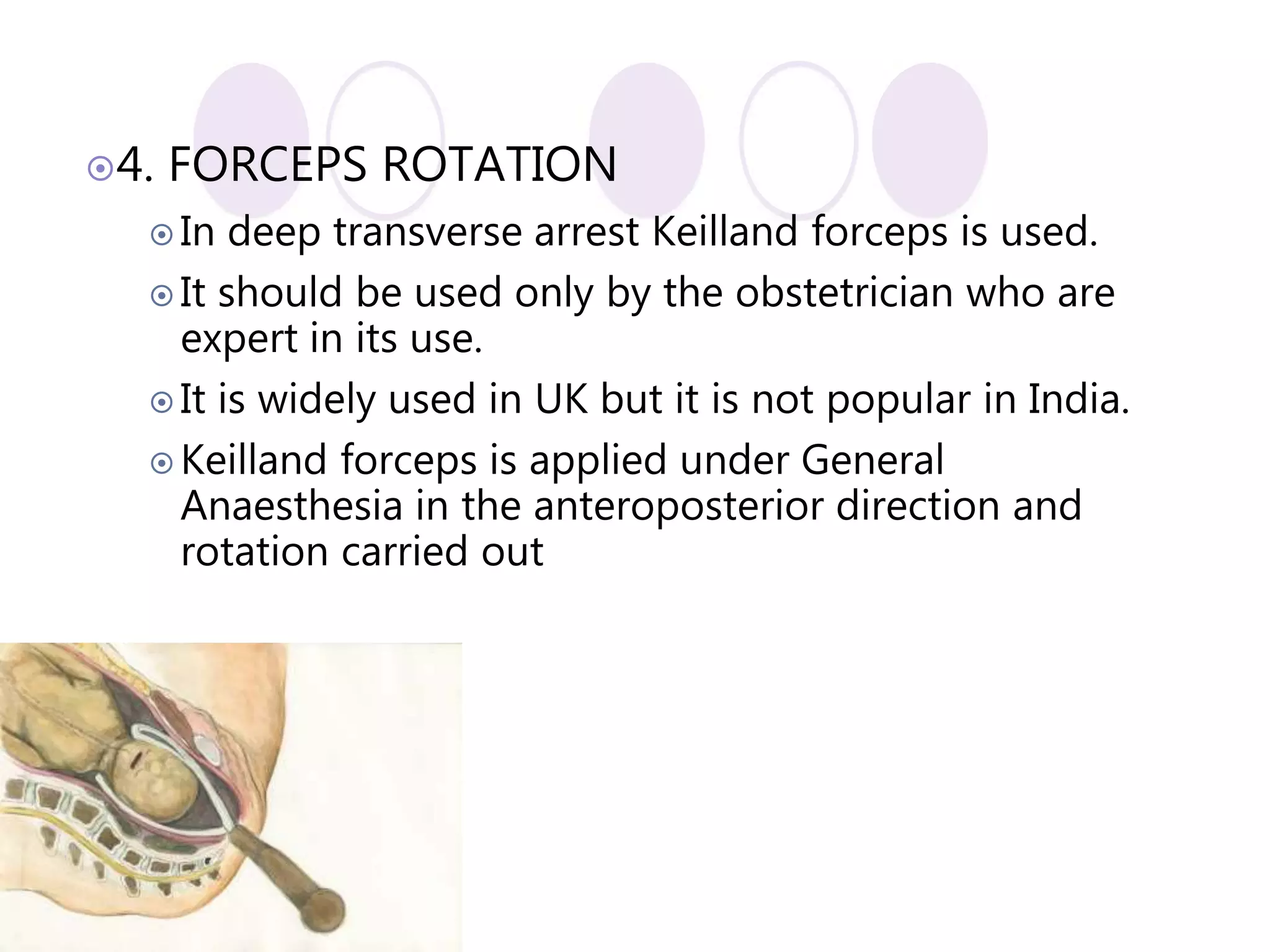 Malposition and malpresentations | PPTX