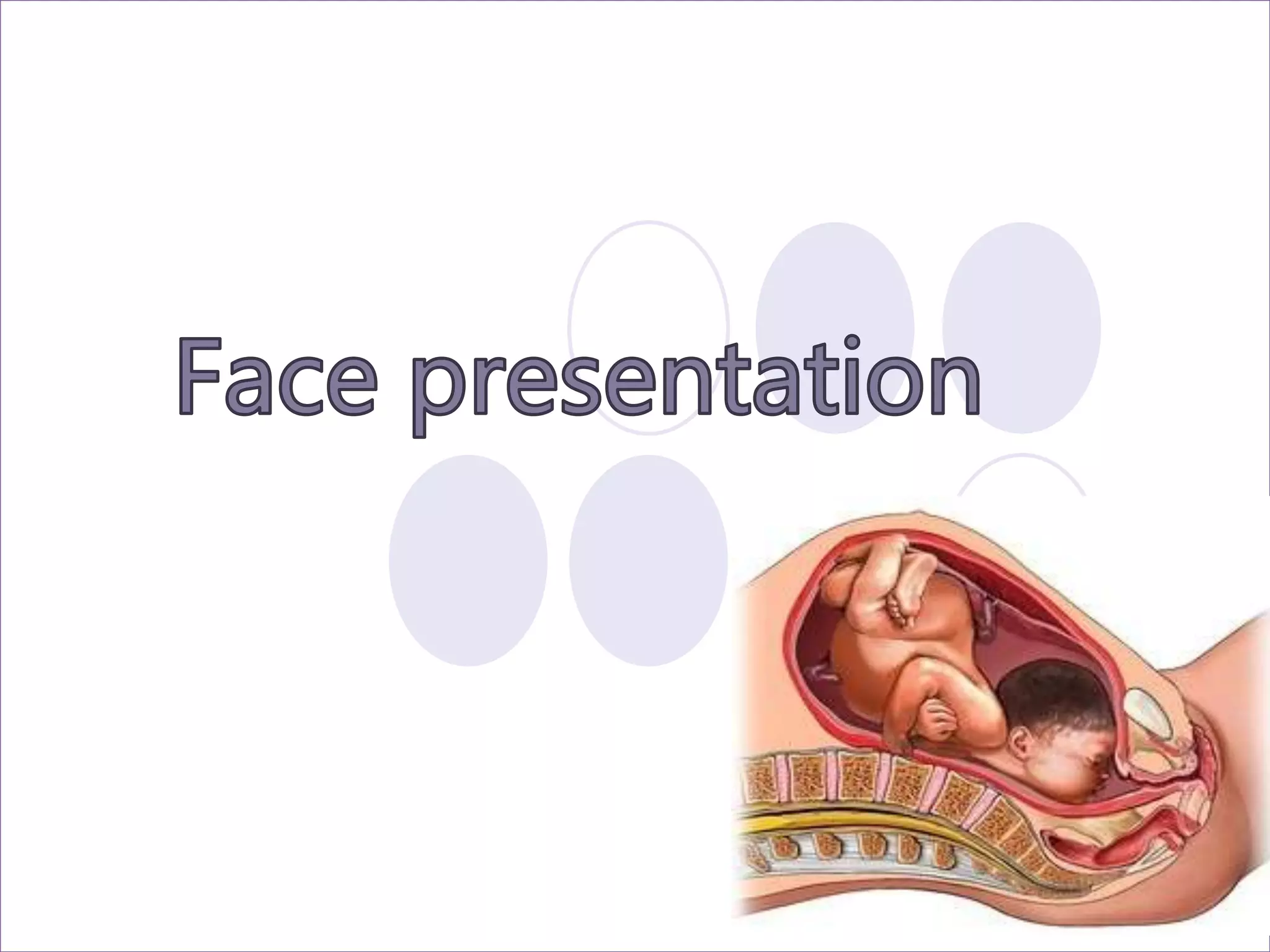 Malposition and malpresentations | PPTX