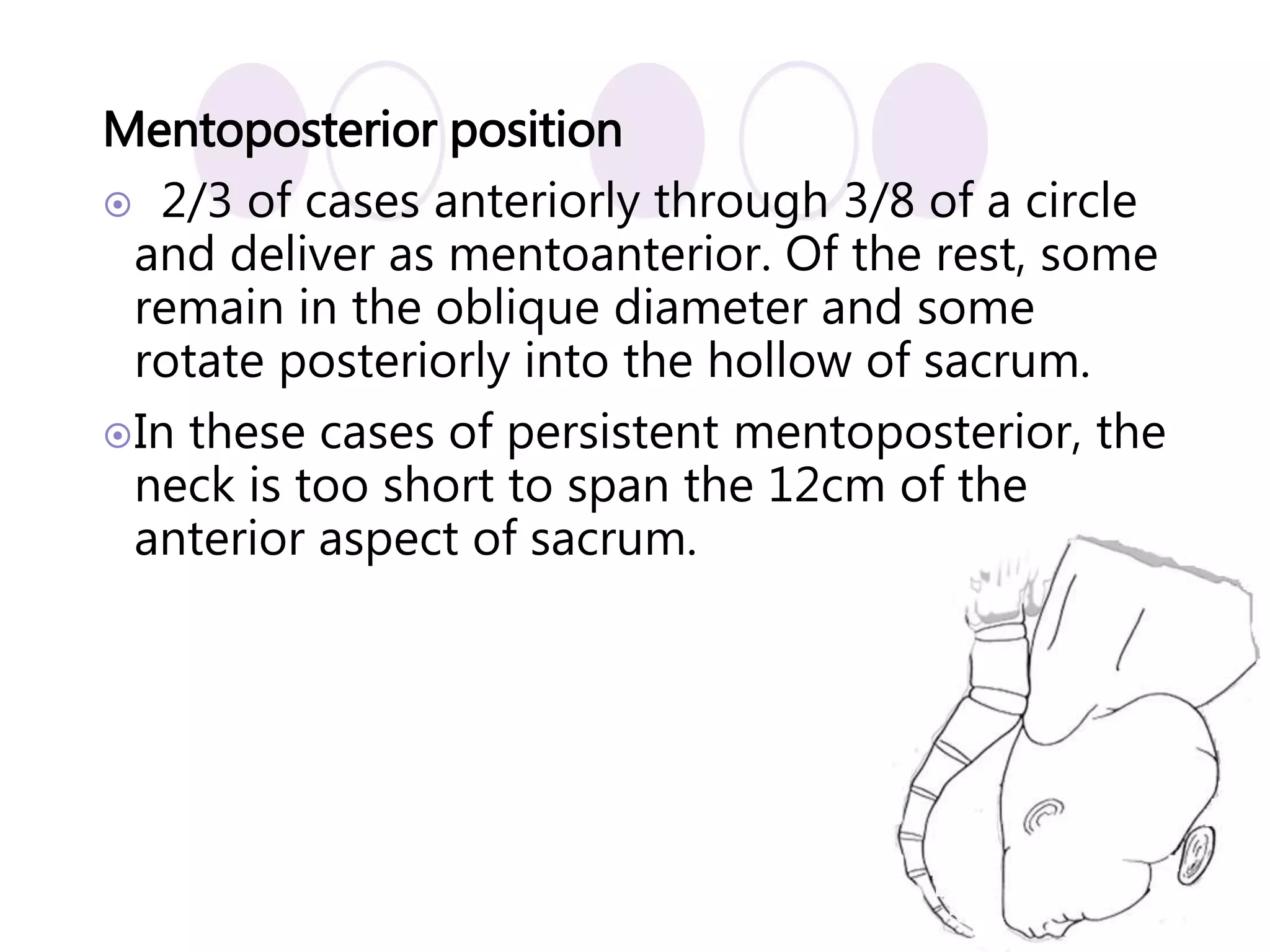 Malposition and malpresentations | PPTX
