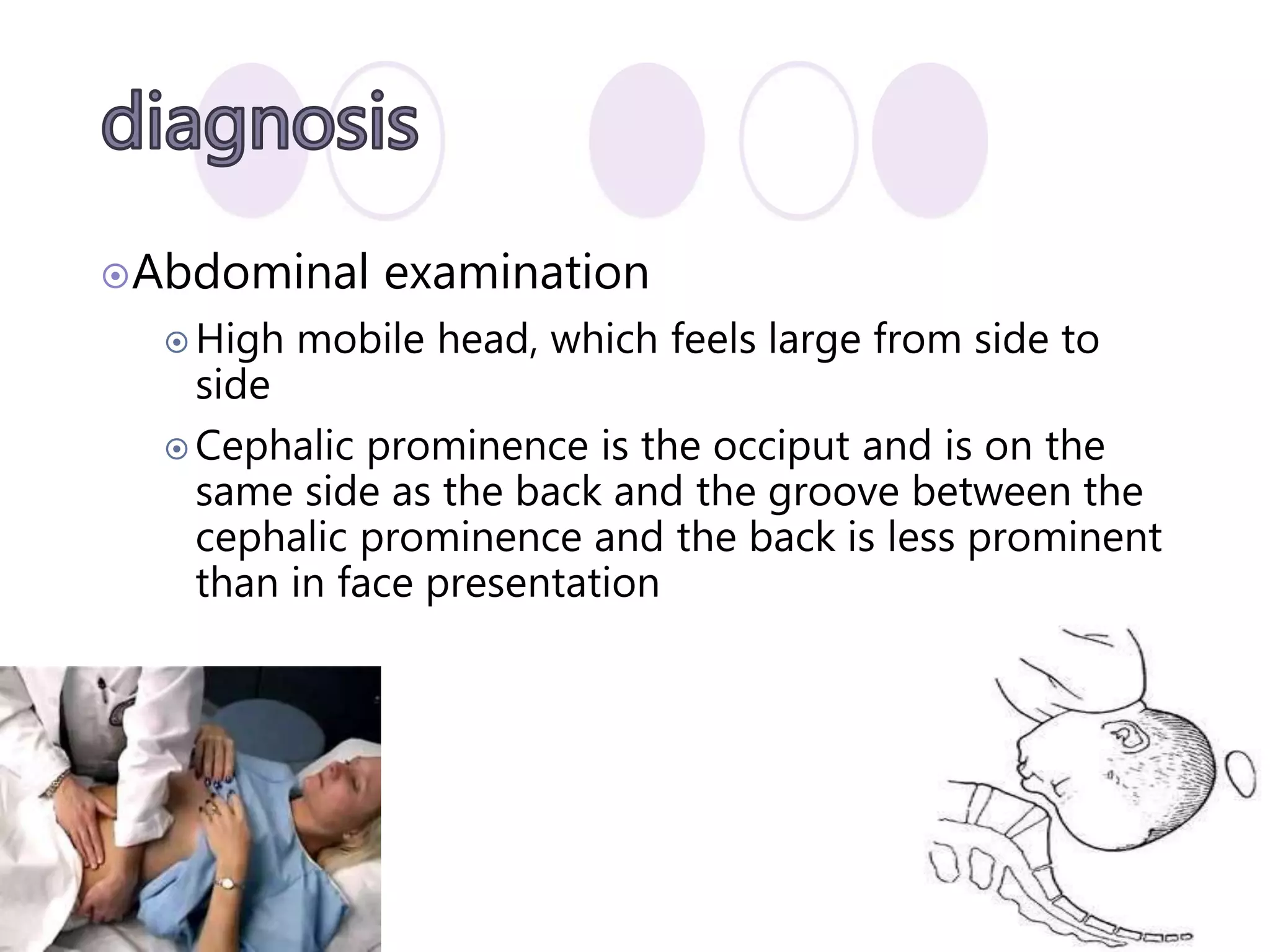 Malposition and malpresentations | PPTX