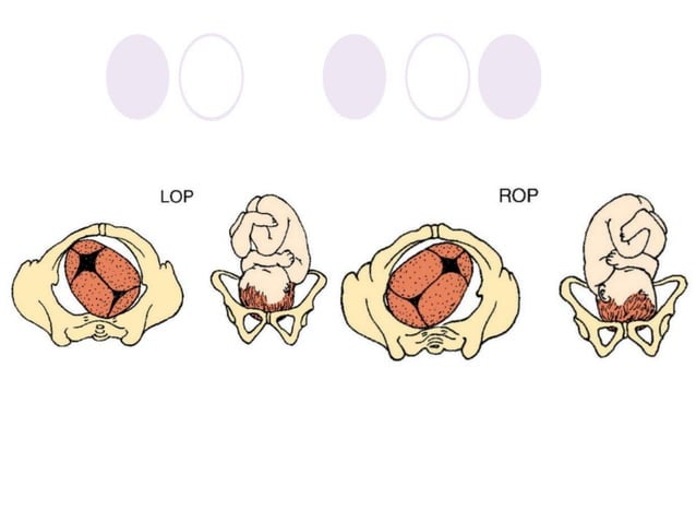 Malposition and malpresentations | PPTX | Pregnancy | Reproductive Health