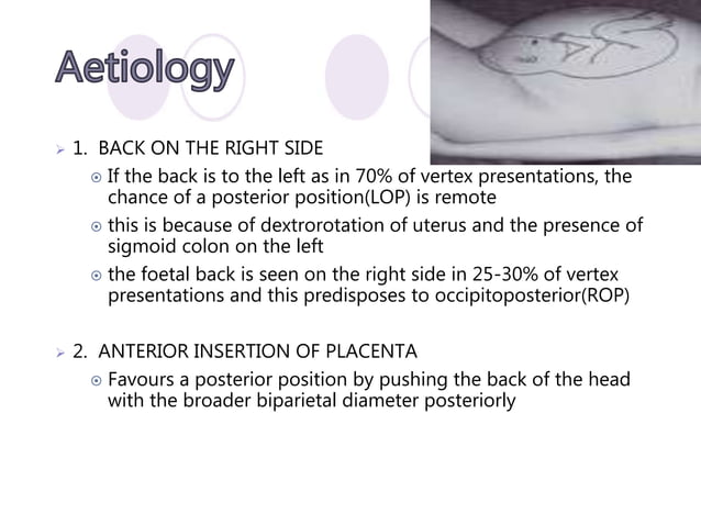 Malposition and malpresentations | PPTX | Pregnancy | Reproductive Health