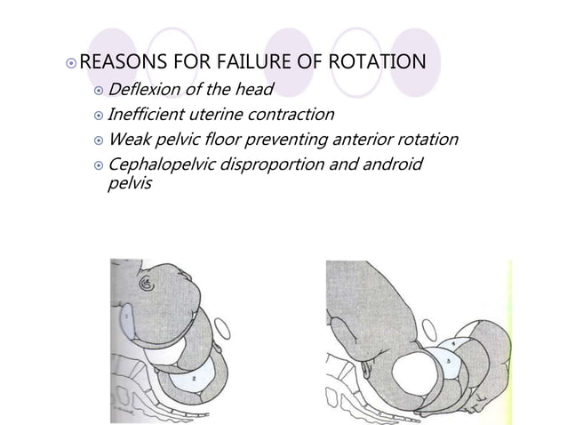 Malposition and malpresentations | PPTX | Pregnancy | Reproductive Health