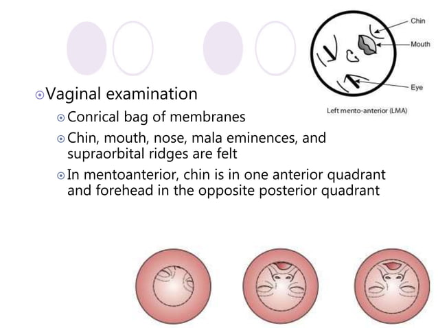 Malposition and malpresentations | PPTX | Pregnancy | Reproductive Health