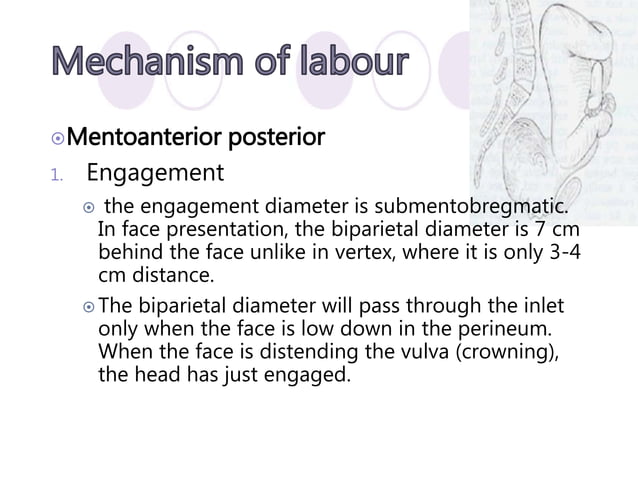 Malposition and malpresentations | PPTX | Pregnancy | Reproductive Health