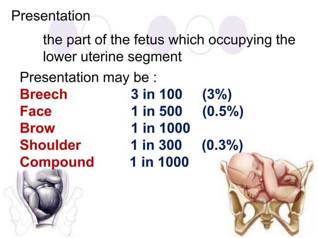 Malposition and malpresentations | PPTX | Pregnancy | Reproductive Health