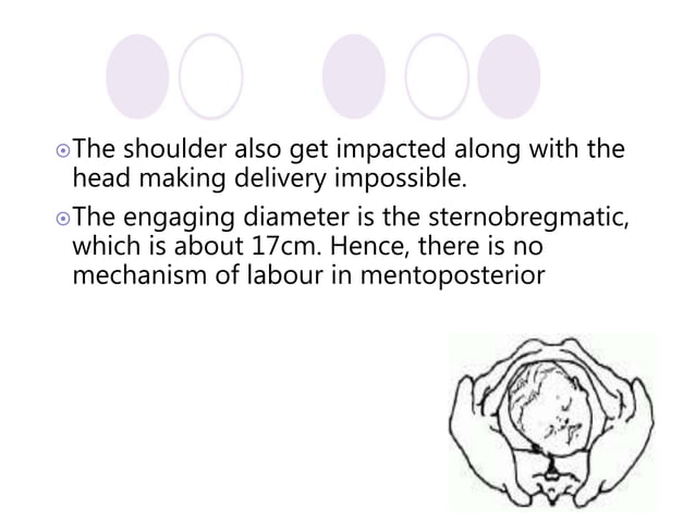 Malposition and malpresentations | PPTX | Pregnancy | Reproductive Health