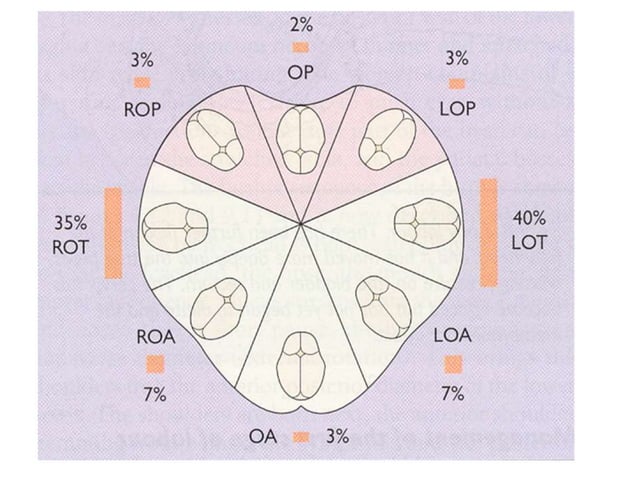 Malposition and malpresentations | PPTX | Pregnancy | Reproductive Health
