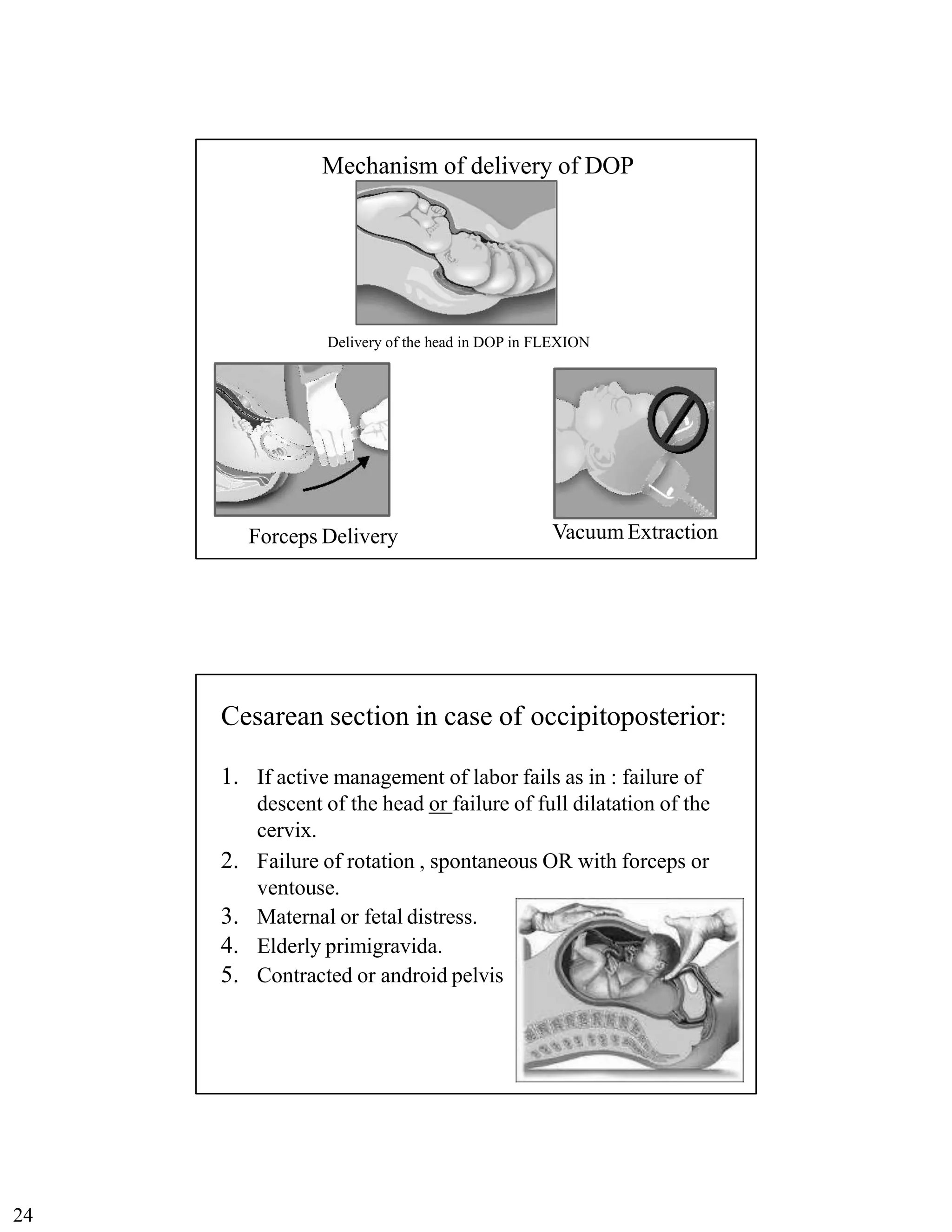 Malposition&malposition | PPTX