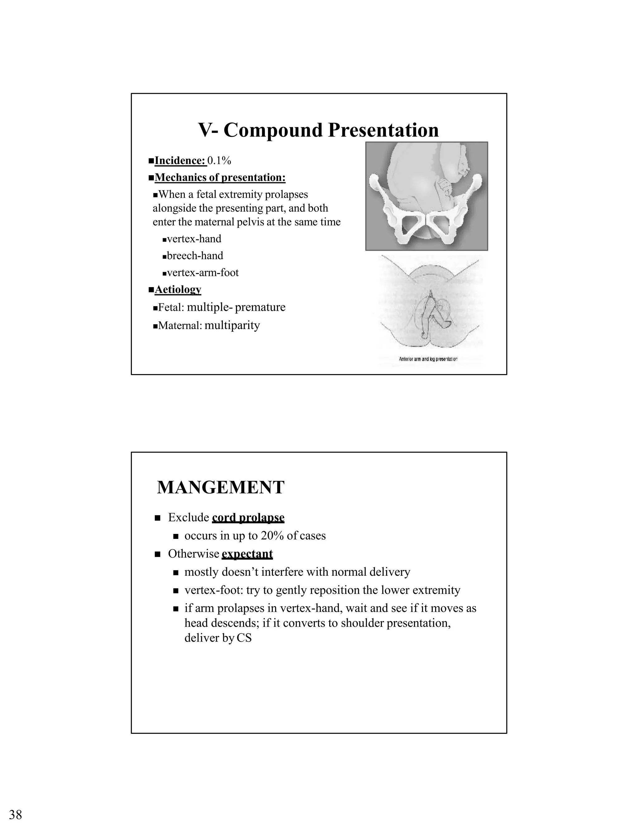 Malposition&malposition | PPTX