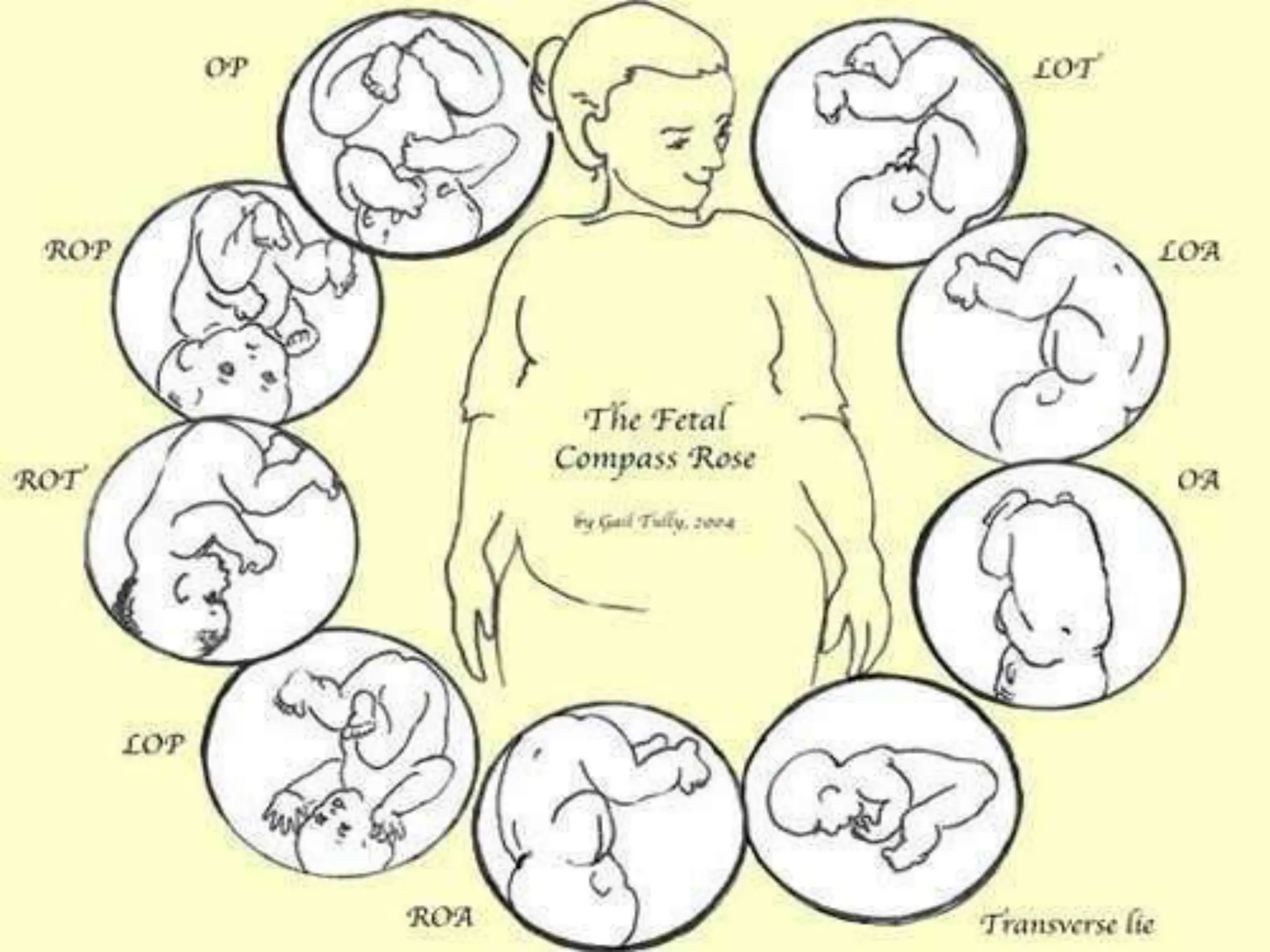 MALPOSITIONS during childbirth .ppt | Pregnancy | Reproductive Health