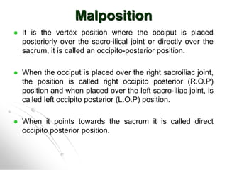 Malposition | PPTX