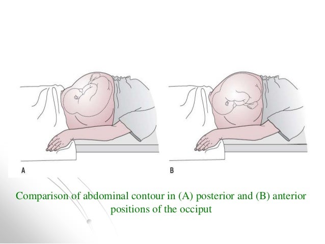 Anterior And Posterior Position For Pregnancy