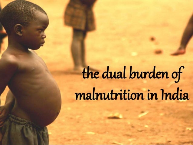 Malnutrition in Indian children