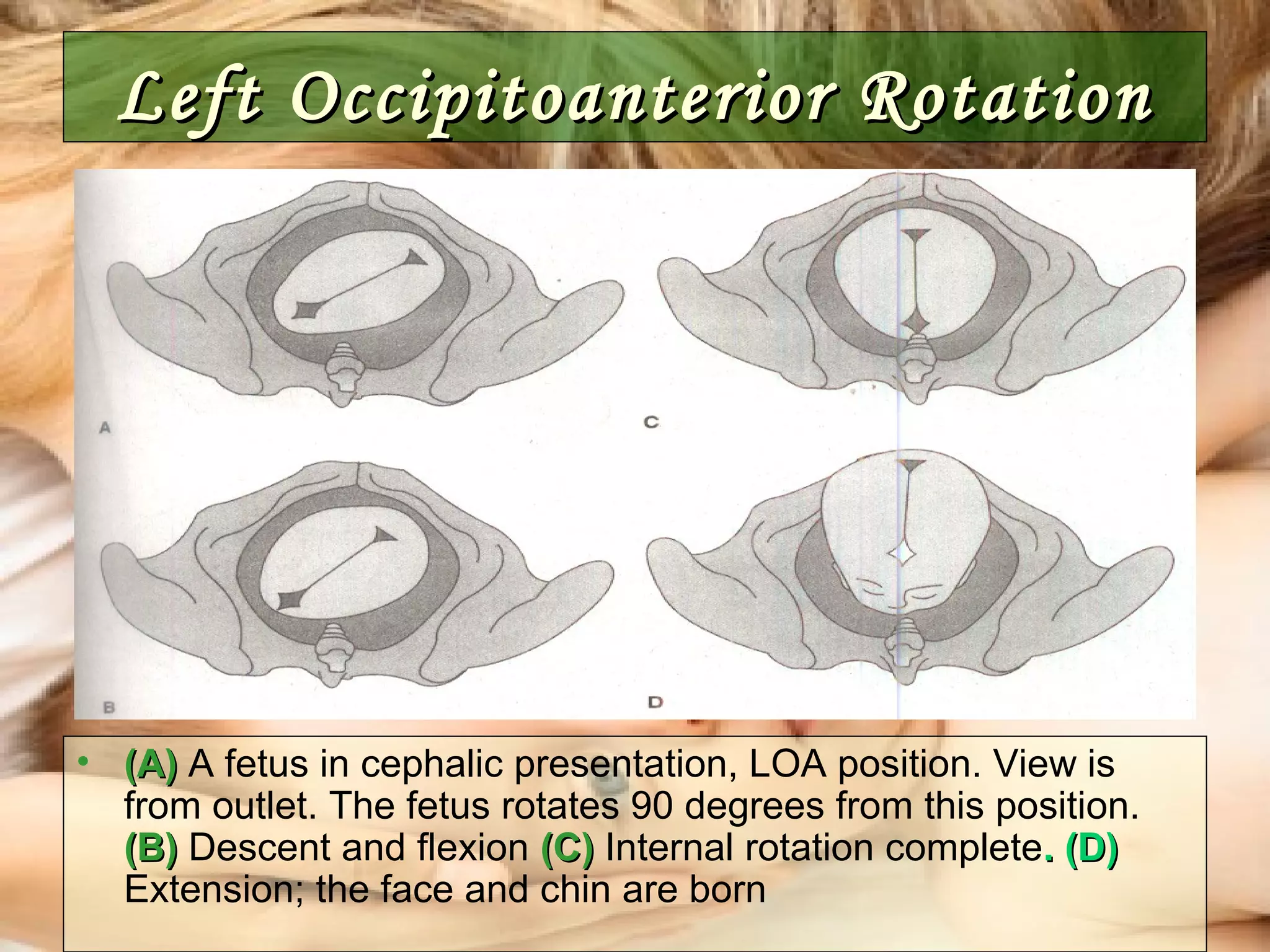 Malpresentation 110220081149-phpapp01 | PPT