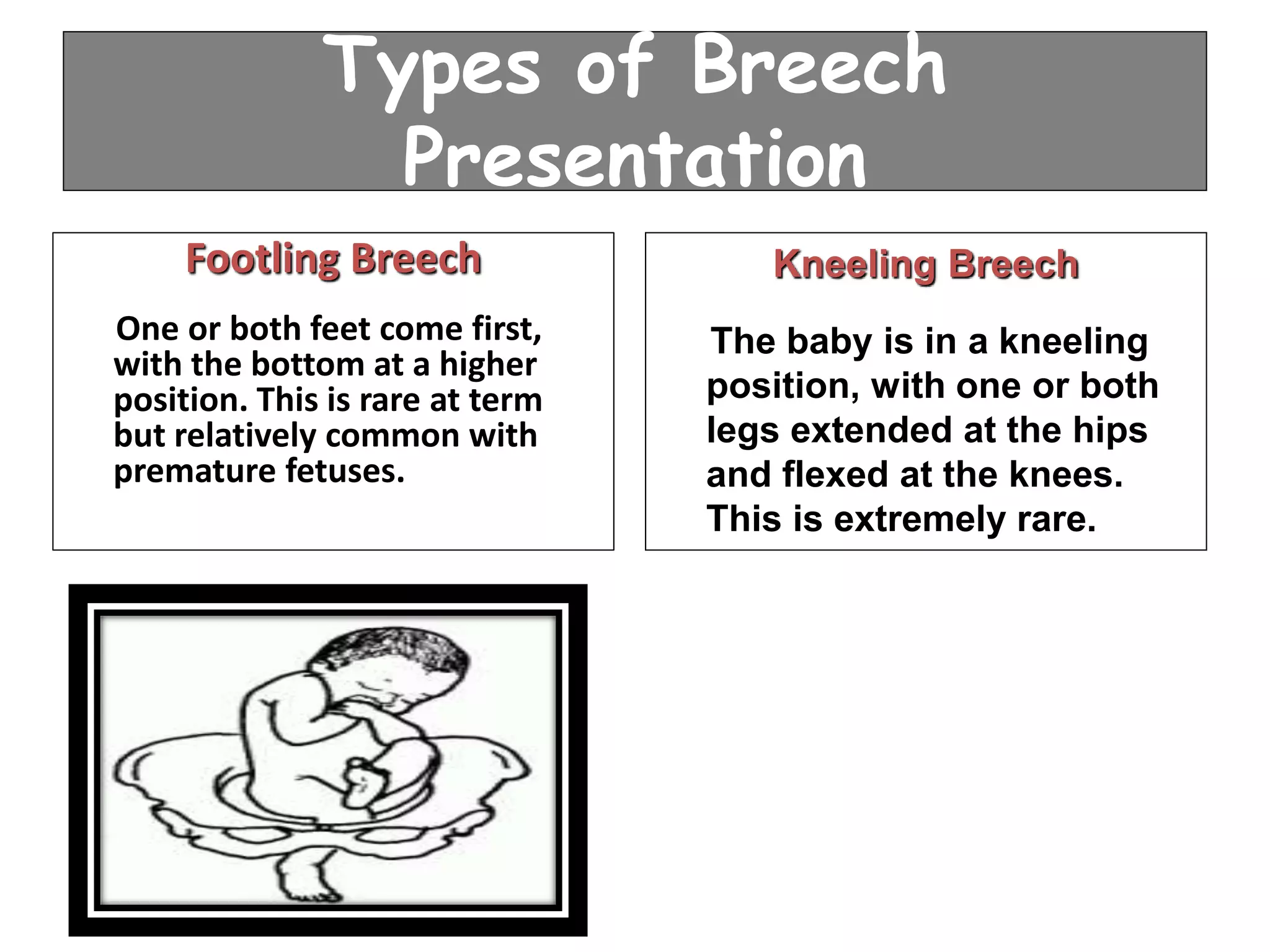 Malpresentation | PPT