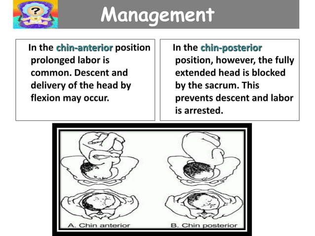 Malpresentation | PPT | Pregnancy | Reproductive Health
