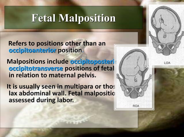 Malpresentation | PPT | Pregnancy | Reproductive Health