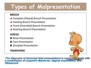 Malpresentation | PPT