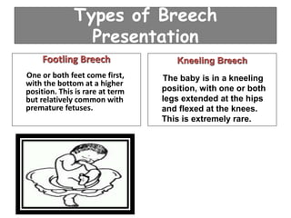 Malpresentation | PPT