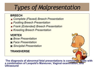 malpresentations | PPTX