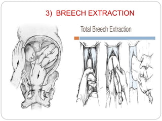 MALPRESENTATION.pptx